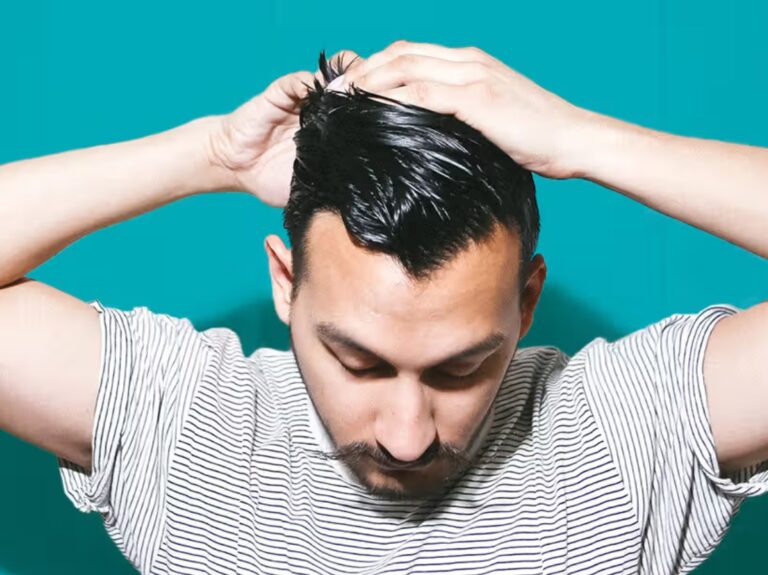 Sons - The Treatments to Fight Hair Loss - Atlanta Celebrity News